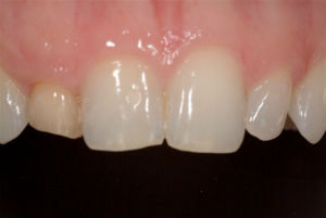 Implants Orange CA, Michael J. Arzouman, D.D.S., Inc.